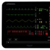 Patient monitoring - Spacelabs Healthcare