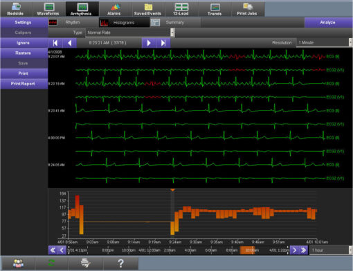 Smart Disclosure - Spacelabs Healthcare
