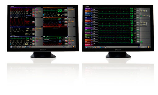 Monitorización centralizada Xhibit XC48 - %sitename% %page% %sep ...