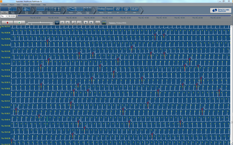 Eclipse Pro extended Holter recorder - Spacelabs Healthcare