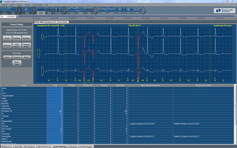 Eclipse Pro extended Holter recorder - Spacelabs Healthcare