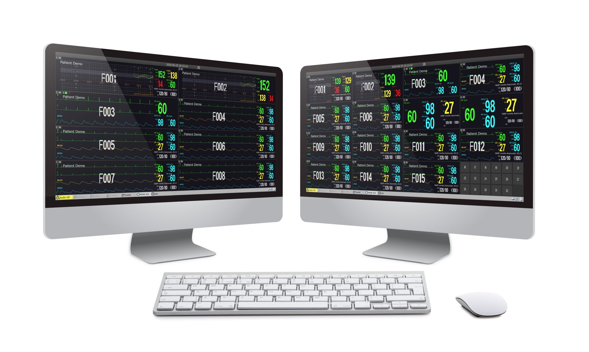 C50 bedside monitor - Spacelabs Healthcare